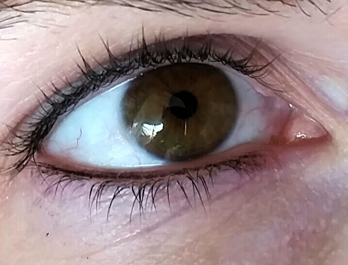 Medications That Hurt Your Eyes What Medications Like Xanax Do To 